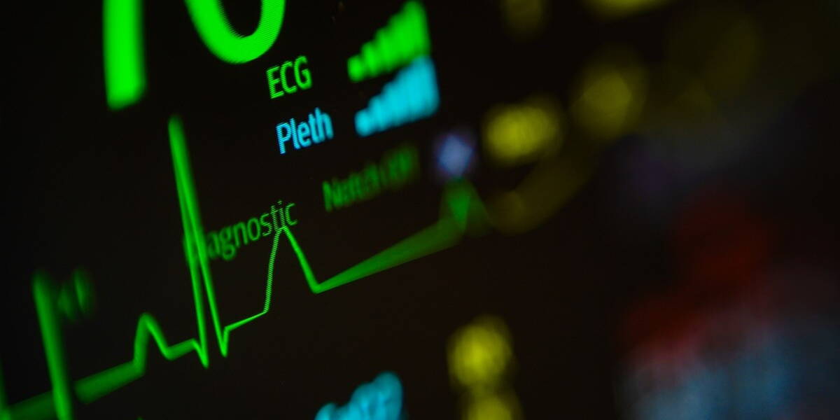 AI-analyse van ECG’s opent weg naar vroege opsporing van COPD | ICT&health