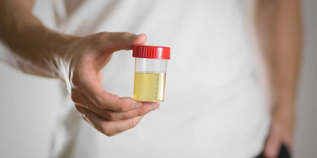 AI clock measures biological age by analyzing urine | ICT&health